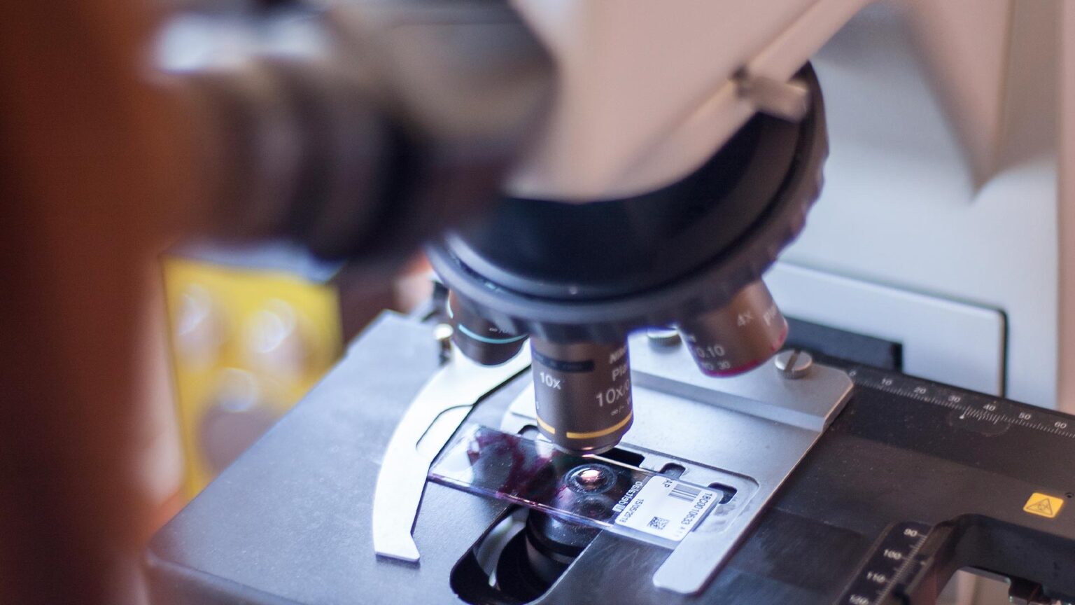 Laboratorio di Analisi Cliniche Minerva – Centro di analisi cliniche ...